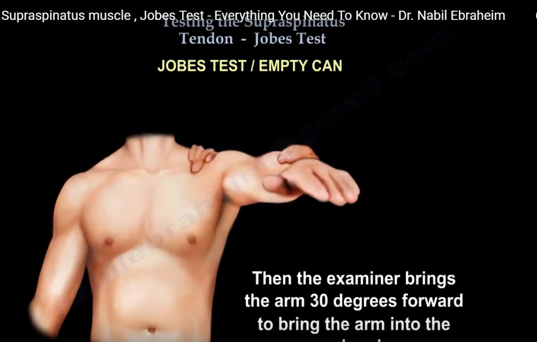 Supraspinatus Muscle Testing And The Jobe Test OrthopaedicPrinciples