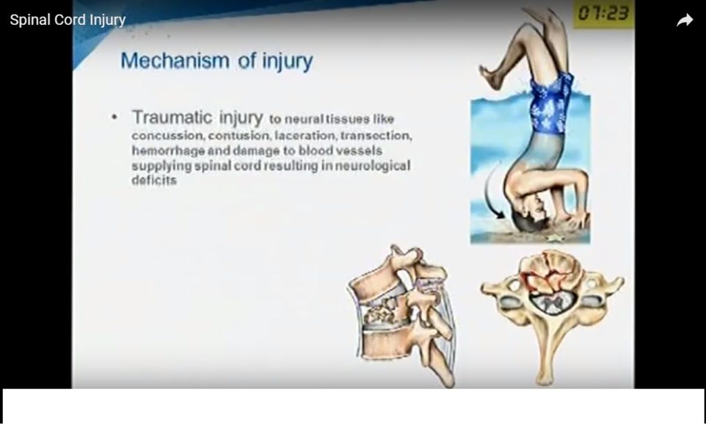 Spinal Cord Injury — OrthopaedicPrinciples.com
