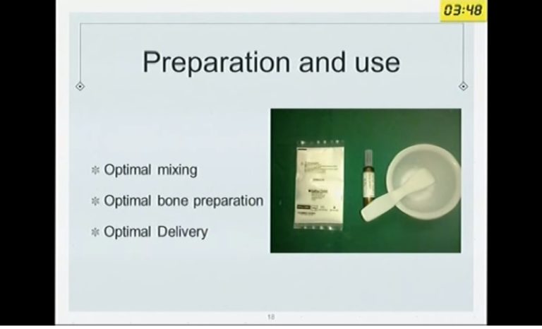 Bone Cement — OrthopaedicPrinciples.com