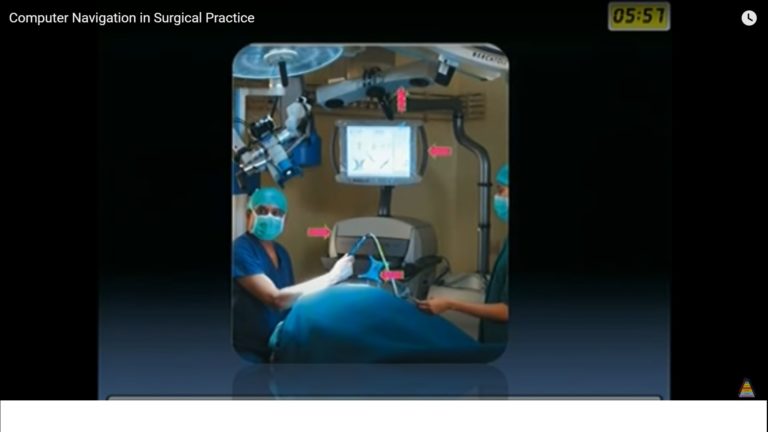 Computer Navigation in Surgical Practice — OrthopaedicPrinciples.com