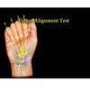 Rapid Hand Neurological Examination — OrthopaedicPrinciples.com