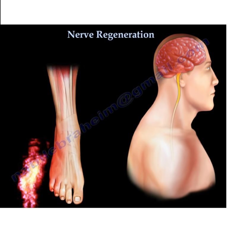 Nerve Regeneration: Principles — OrthopaedicPrinciples.com
