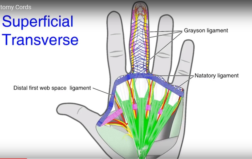 Anatomy of Cords in Dupuytren’s disease — OrthopaedicPrinciples.com