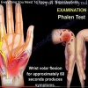 Pronator Teres Syndrome — OrthopaedicPrinciples.com
