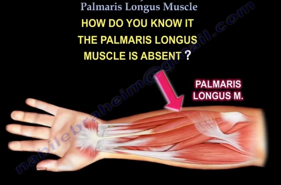 Anatomy of #Palmaris Longus — OrthopaedicPrinciples.com