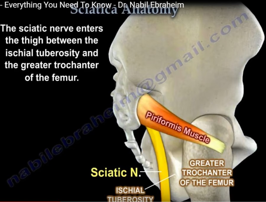 Sciatica Anatomy — OrthopaedicPrinciples.com