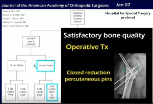Proximal Humeral fractures: Principles of Surgery ...