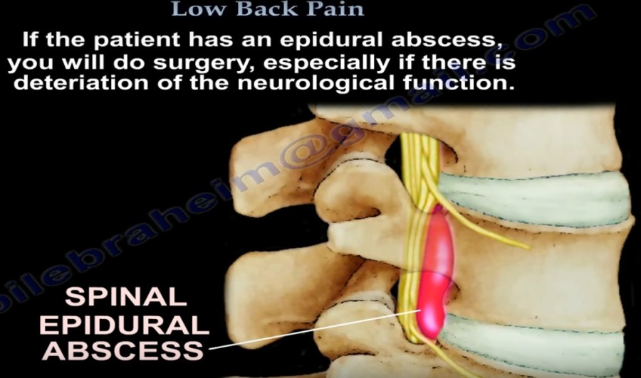 Spine Concepts: Low Back Pain — OrthopaedicPrinciples.com Spine Concepts: Low Back Pain — OrthopaedicPrinciples.com