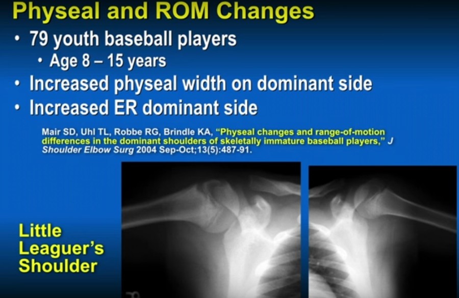 Sports Shoulder- Injuries in Children — OrthopaedicPrinciples.com