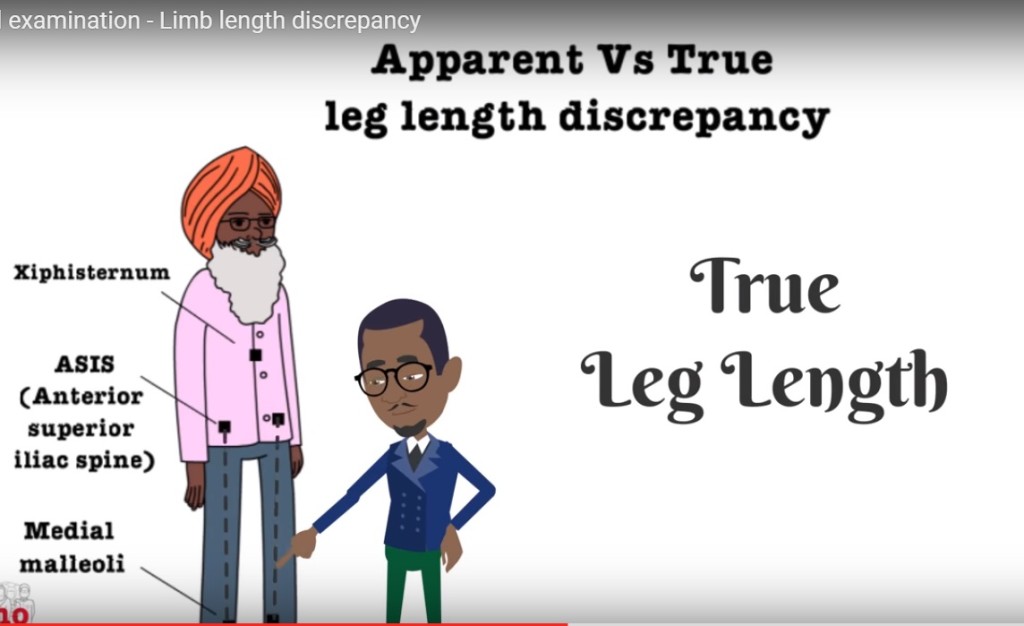 Limb length Assessment — OrthopaedicPrinciples.com