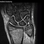 Anatomy of the Volar side of the Wrist — OrthopaedicPrinciples.com