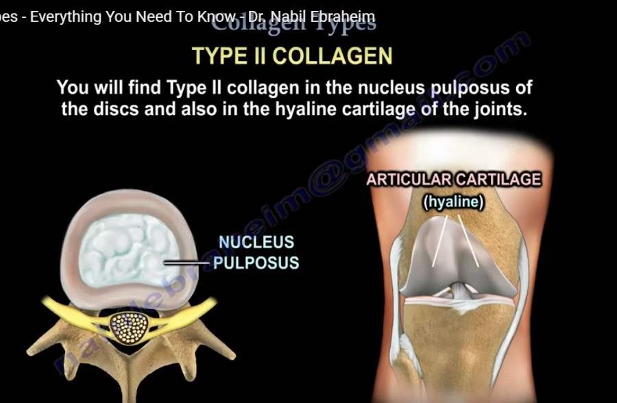 Types of Collagen and its implications — OrthopaedicPrinciples.com