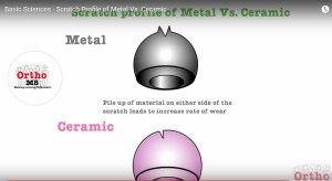 Scratch Profile of Metal Vs Ceramic — OrthopaedicPrinciples.com