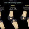 Knee Dislocation- Review — OrthopaedicPrinciples.com