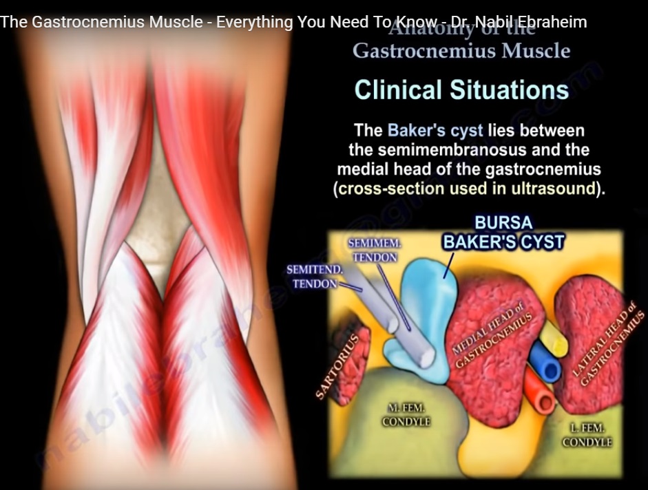Anatomy Of The Gastrocnemius Muscle OrthopaedicPrinciples Anatomy Of The Gastrocnemius Muscle OrthopaedicPrinciples
