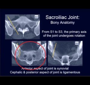 The Sacroiliac Joint: Anatomy, Function and Interventions ...