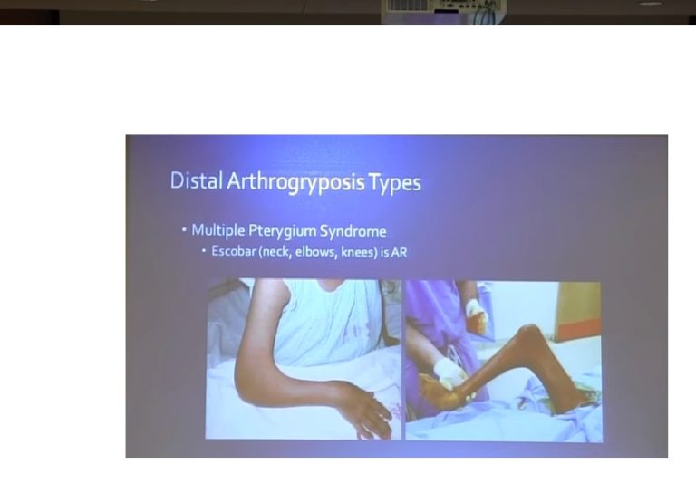 Introduction to Arthrogryposis — OrthopaedicPrinciples.com