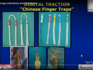 Wrist Arthroscopy, Indications and Techniques — OrthopaedicPrinciples.com