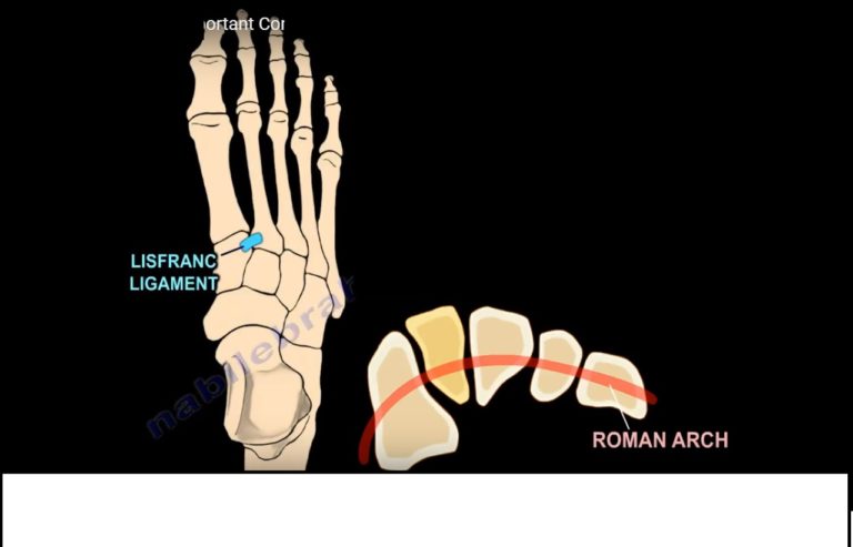 Lisfranc Fracture Dislocation — OrthopaedicPrinciples.com