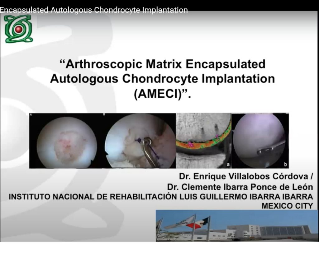 Matrix Encapsulated Autologous Chondrocyte Implantation ...