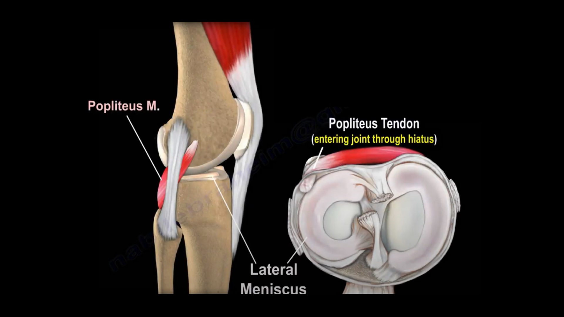 Anatomy Of The Popliteus Muscle OrthopaedicPrinciples Anatomy Of The Popliteus Muscle OrthopaedicPrinciples