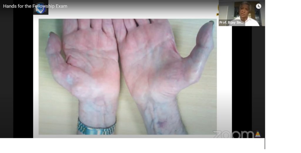 Ideal Examination Of Hand — OrthopaedicPrinciples.com