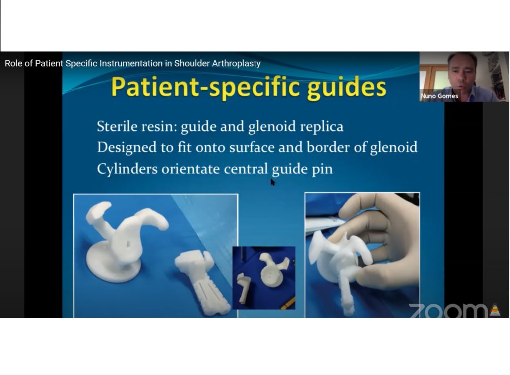 Patient Specific Instrumentation in Shoulder Arthroplasty ...