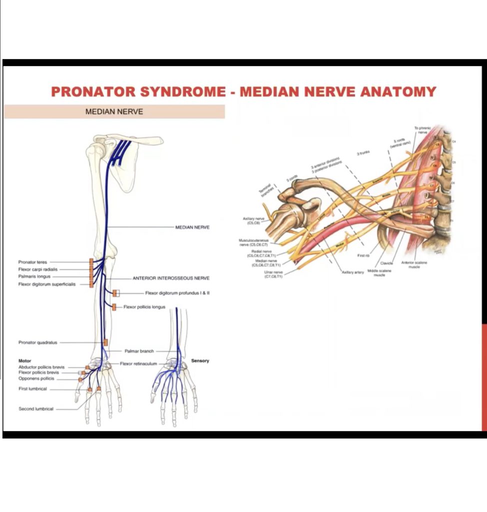 Upper Limb Neuropathies- Pronator Syndrome, Radial Tunnel Syndrome ...