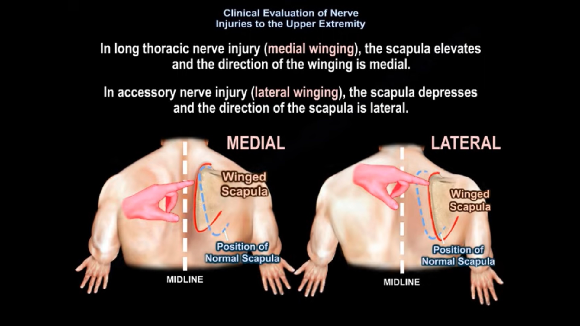 Clinical Exam Of Upper Limb Nerve Injuries OrthopaedicPrinciples Clinical Exam Of Upper Limb Nerve Injuries OrthopaedicPrinciples