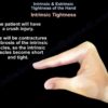 Intrinsic Minus and Intrinsic Plus Hand — OrthopaedicPrinciples.com