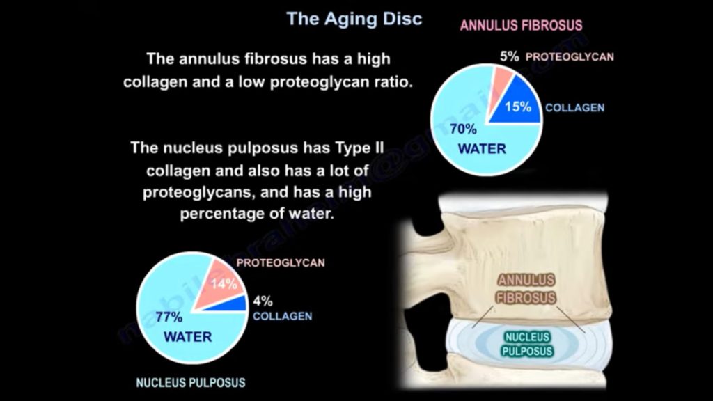 The Aging Disc — OrthopaedicPrinciples.com