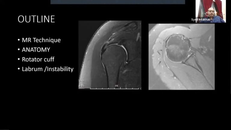 Shoulder MRI Made Easy — OrthopaedicPrinciples.com